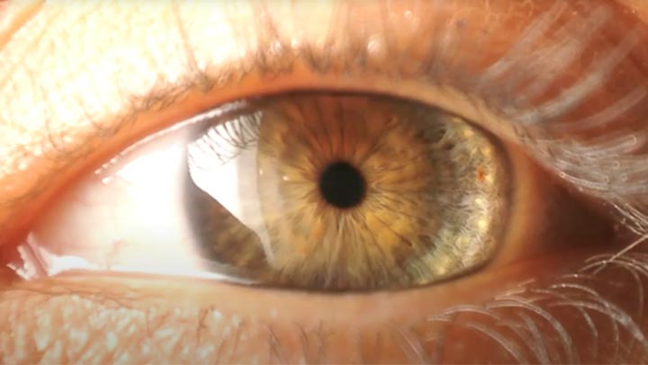 pe-topic-dilating-eye-drops | South Bay Ophthalmology